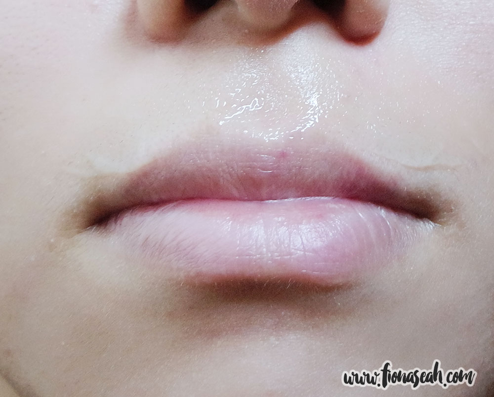 Zap Those Unruly Upper Lip Hair with IPL by EXPRESSIONS | fionaseah.com