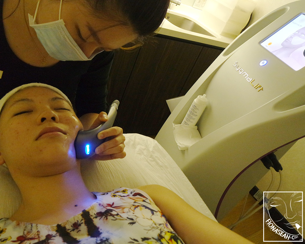 HIFU Sygmalift at The Clifford Clinic: Non-Invasive Facelift for a V ...